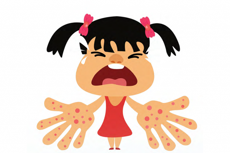 Oroxylum indicum Extract for antiviral against HFMD - iNT Mahidol