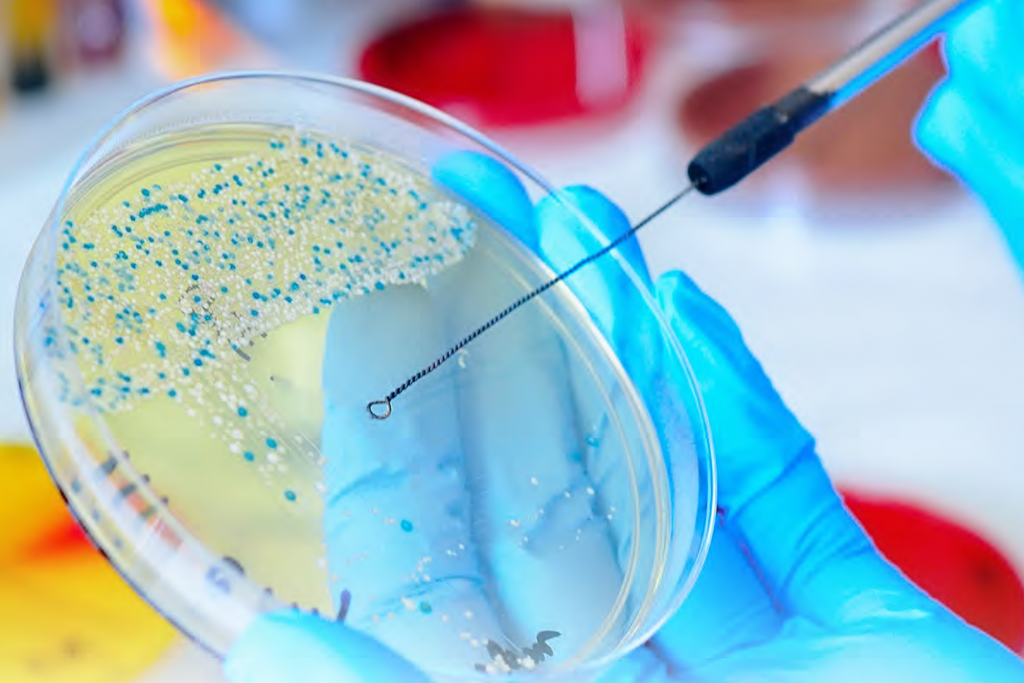 Slide incubator rack - iNT Mahidol